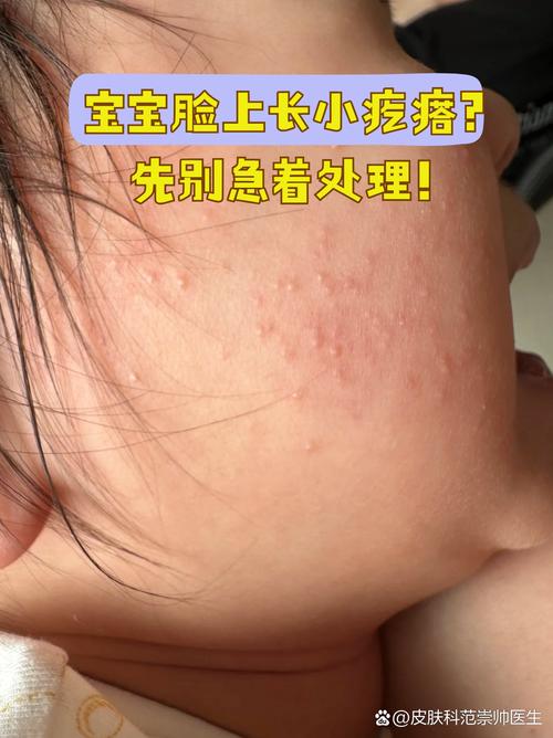 屁股上紫色疙瘩图片图标