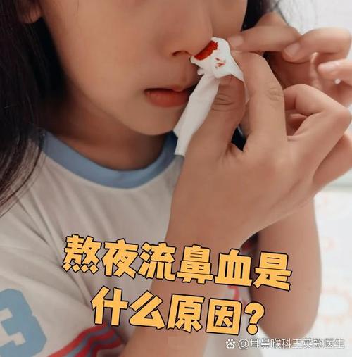 睡觉为什么会流鼻血图标