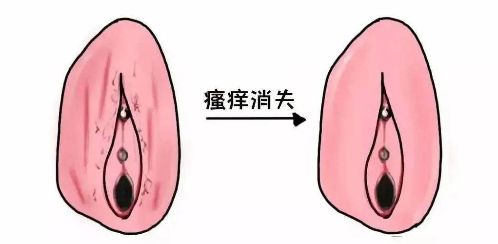 女性私密部位变黑原因图标