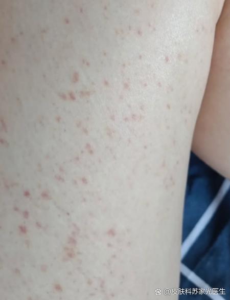 手机没有信息但是有红点