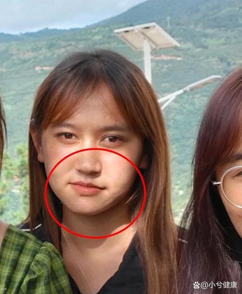 拍照嘴巴歪是真歪吗截图
