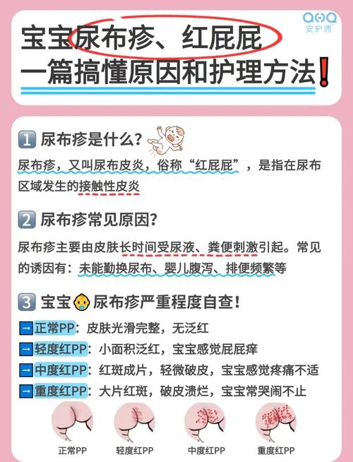 小布总是突然跳出来怎么回事截图
