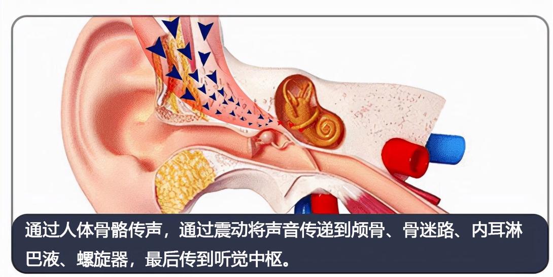 骨传导耳机的利弊