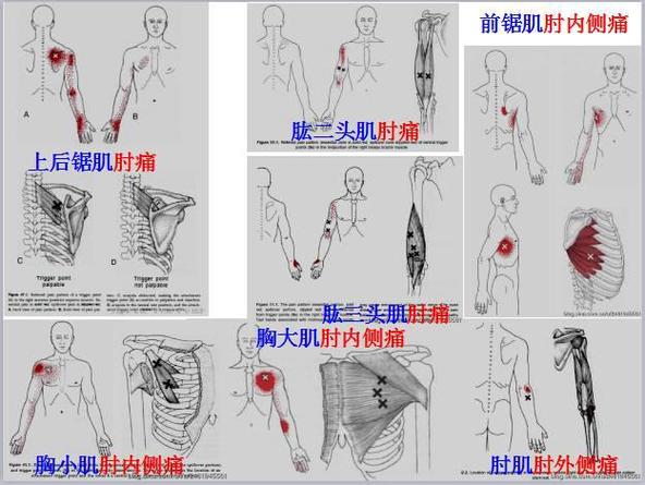 痛点痒点和兴奋点的含义图标