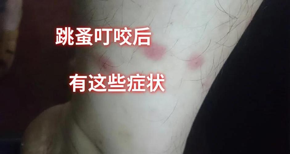咬人后的图片图标