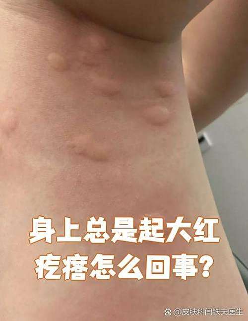 我身上起了红疙瘩特痒的图标