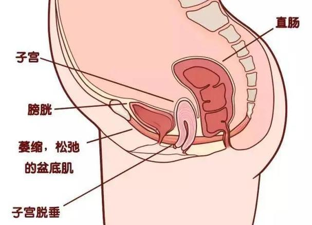 产后松弛怎么恢复紧致图标