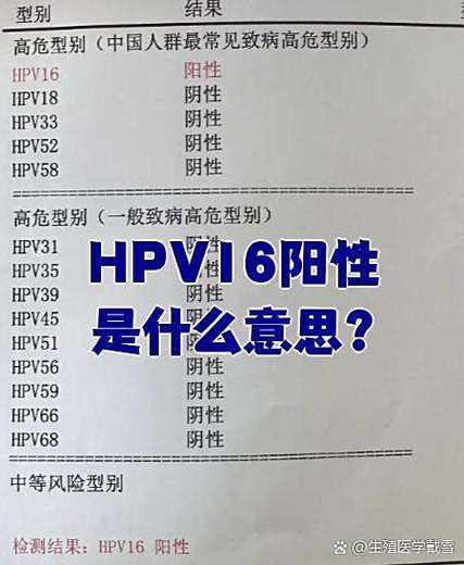 女人病毒感染是什么病图标