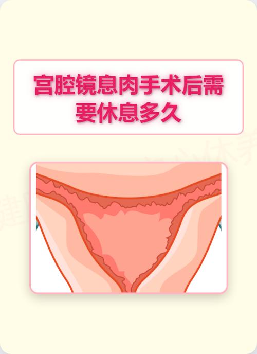 做宫腔镜需要休息多久才能恢复图标
