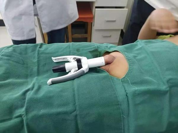 割包过程真人版视频皮截图