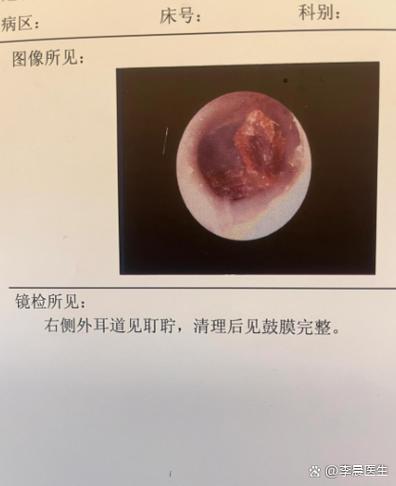 单侧耳朵有杂音滋滋响图标