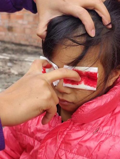 小孩被挖眼睛视频截图
