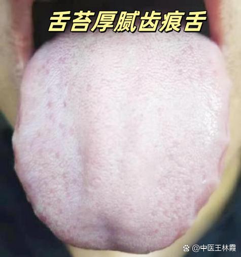 白色圈痕的解决方法图标
