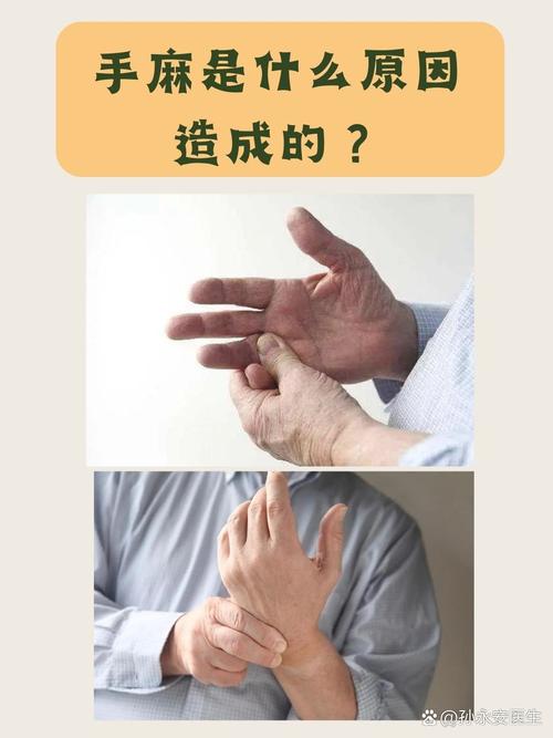 治疗手麻的药图标