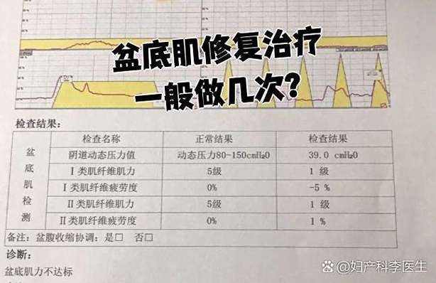 盆底肌恢复要做几次图标