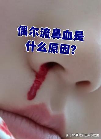 偶尔流鼻血正常吗截图