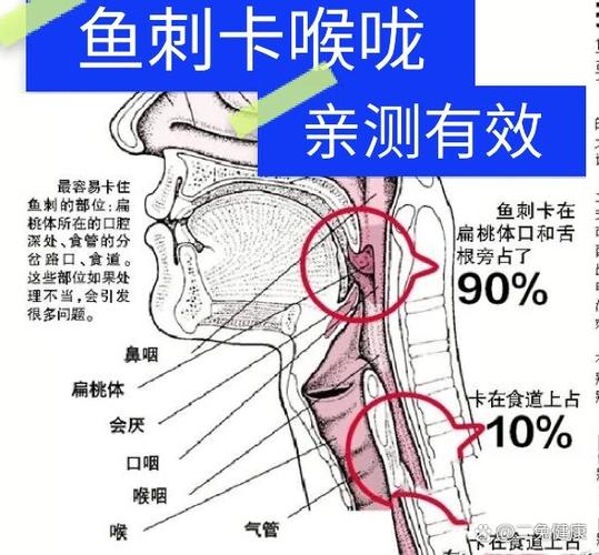 鱼刺扎舌头能否自愈图标