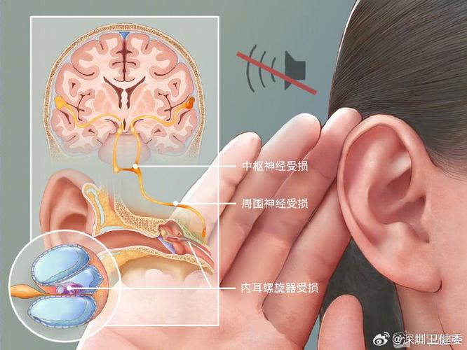 我哭着喊他停下,耳聋的他却摘下助听p图标