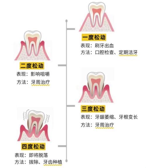 牙齿松动是什么原因截图