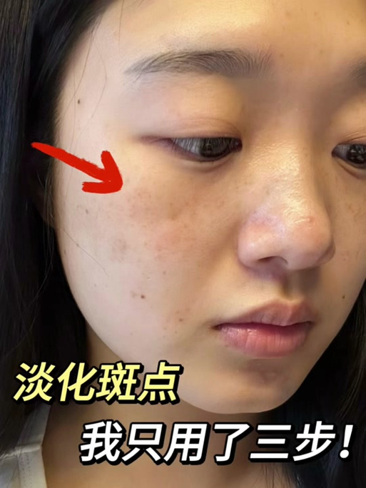 皮肤买错了怎么补救图标