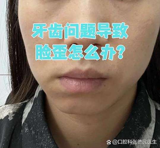 牙齿错颌会引起脸歪么图标