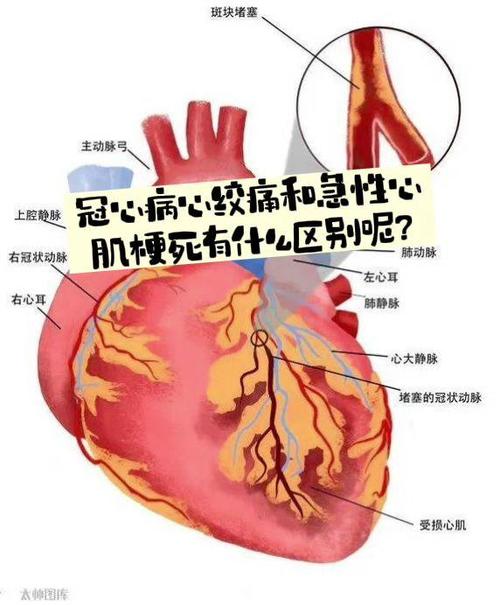 lgt医学上代表什么图标