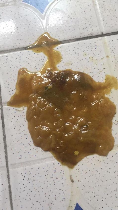 大便拉出果冻状透明物图标