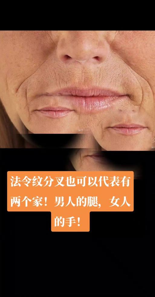 女人有福气的法令纹截图