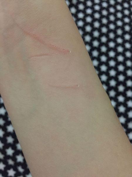 被一个月小奶猫咬了要打针吗图标