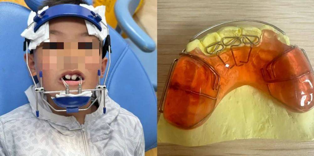 怎么删除苹果面容图标