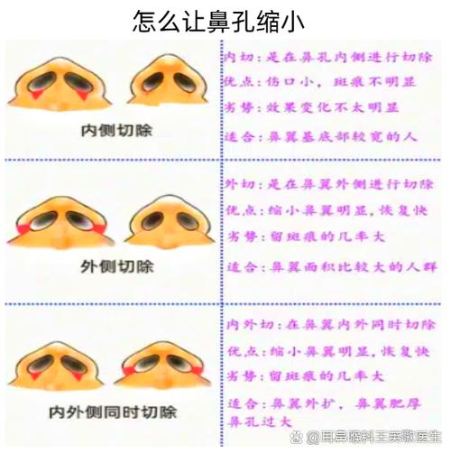 鼻子大怎么变小图标