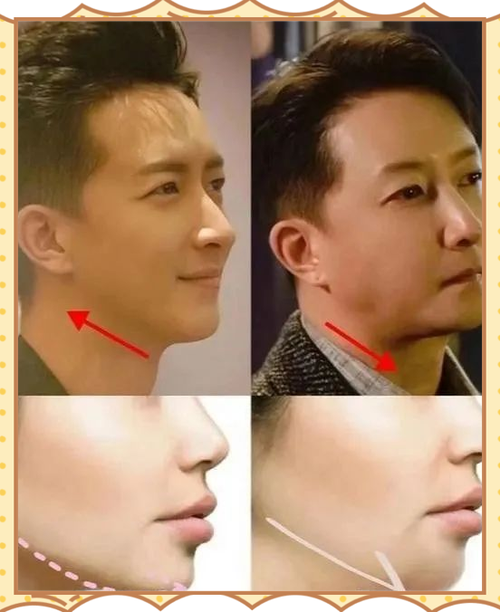 男人头顶尖是福气还是灾气