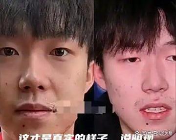 滤镜和美颜有什么区别图标