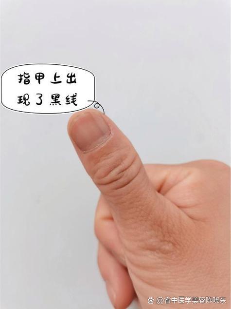 手机屏幕有一条竖黑线图标