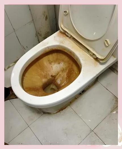 马桶下水很慢很慢什么原因图标