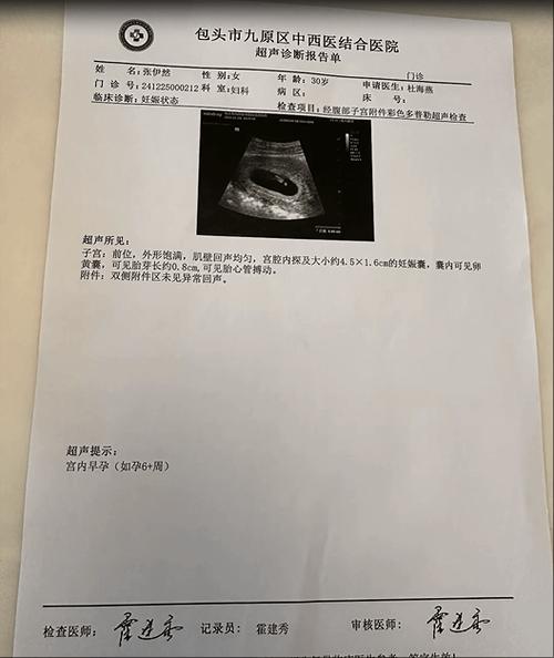 B超单子图片图标