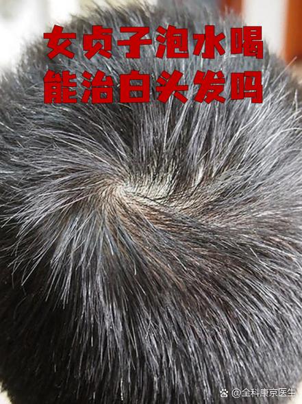 女贞子去除白发的方法图标