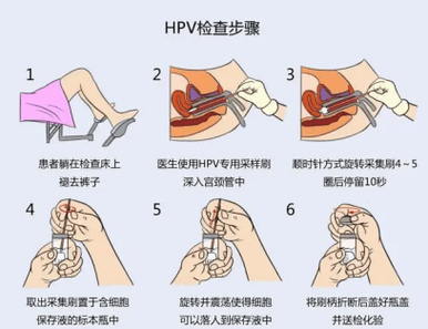 hpv核酸检测怎么检查图标