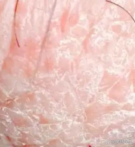 女性私处脱皮怎么回事啊截图