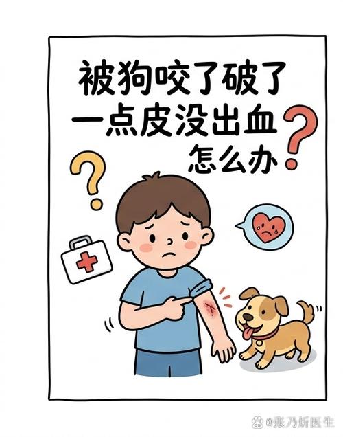 被家狗咬破了一点皮有事吗图标