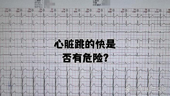 正常人心跳截图