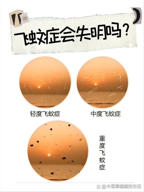 飞蚊症多久会消失图标
