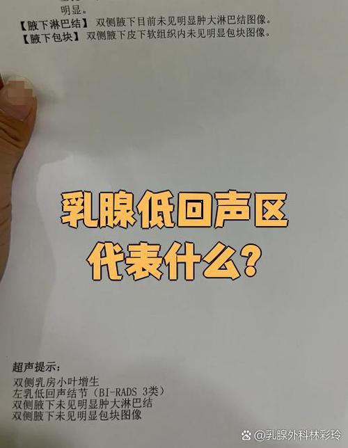低回声区是什么意思啊图标