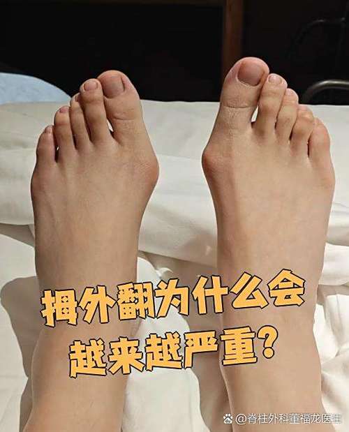 b无力合拢红肿外翻一般几天消图标