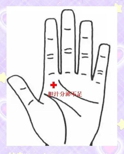 右手掌发麻应警惕的病图标