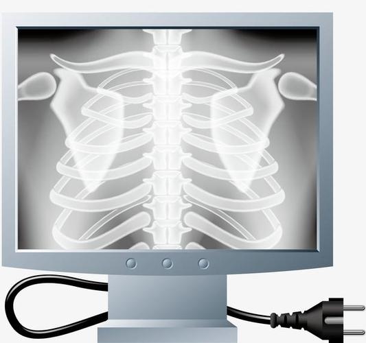 x-ray是什么