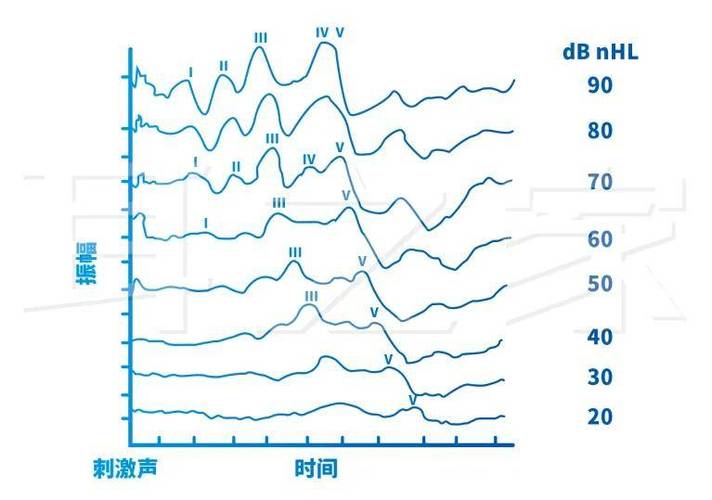 手机用了耳机后声音变小图标