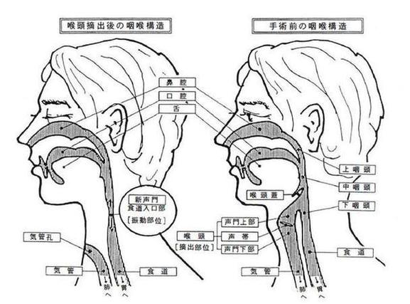 唱歌的技巧有哪些截图