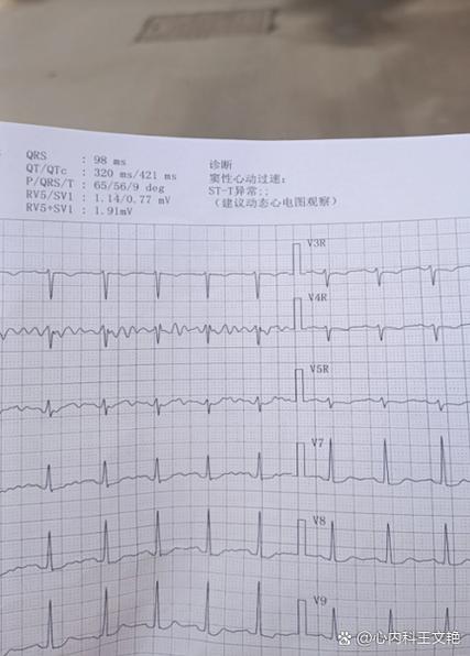 心率100左右有危险吗
