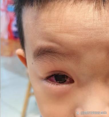 小孩眼睛右眼流眼水图标